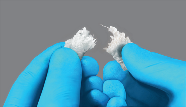 Biogennix’s Agilon Moldable Bone Graft Solution Achieves Sales Surge ...