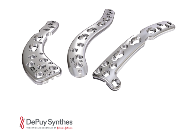 DePuy Synthes Launches 2.7 mm Variable Angle Locking Compression Plate ...