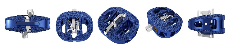 Arkansas Neurosurgeon Successfully Implants his 400th ENZA-A Titanium ...