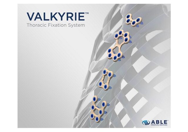 Tsunami Medical Announces the Launch of Ortigia-J and Caprera, 3D ...