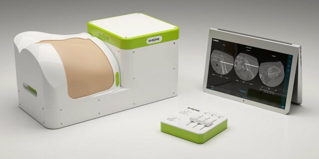 Orthofix Announces U.S. Launch and First Patient Implant of 3D-Printed ...