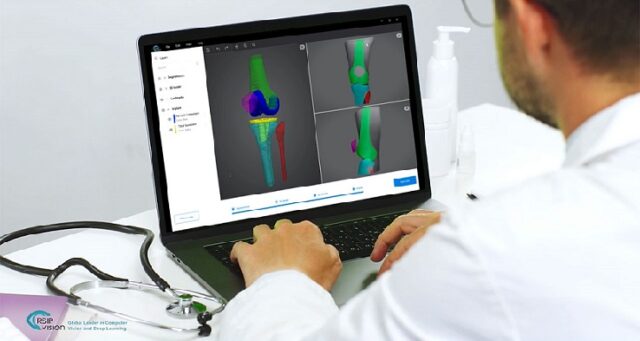 RSIP Vision Announces Patient-Specific, Intraoperative Registration ...