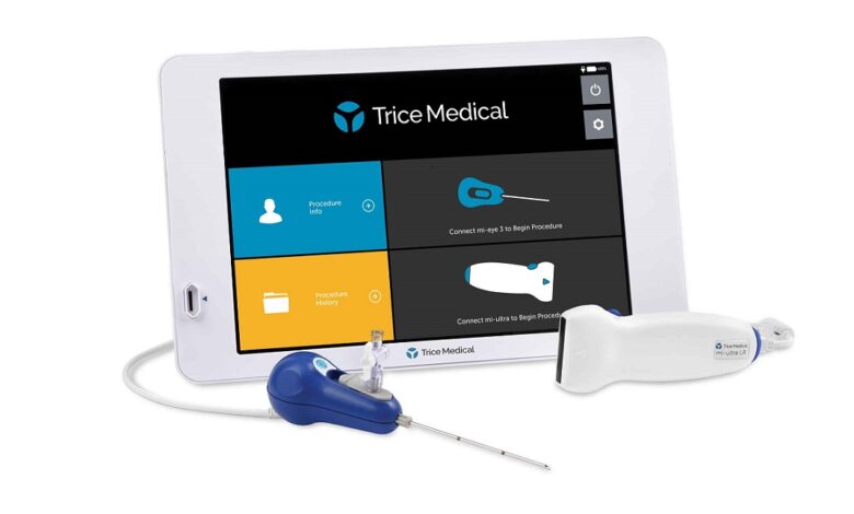 Trice Medical breaks surgical boundaries with the world’s first FDA ...