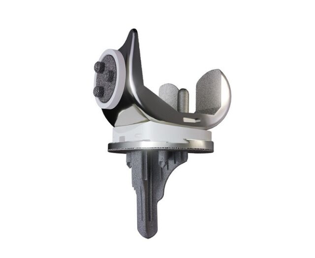 Smith+Nephew introduces the LEGION™ CONCELOC™ Cementless Total Knee ...