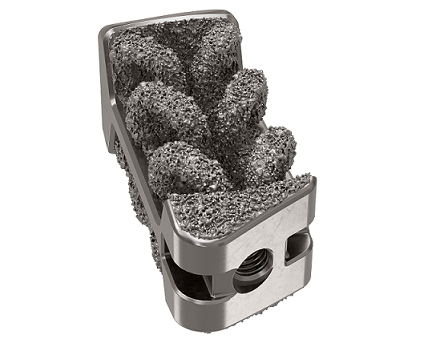 Camber Spine's SPIRA-P and SPIRA-T Devices Enter Full National Launch ...