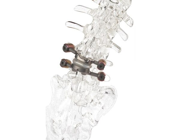 Premia Spine’s TOPS™ Spinal Joint Replacement Shows Potential to ...