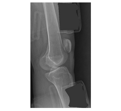 RSIP Vision Presents Successful Preliminary Results from Clinical Study ...