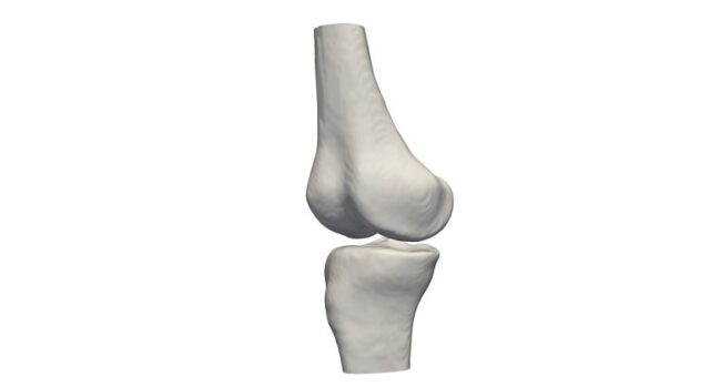 RSIP Vision Presents Successful Preliminary Results from Clinical Study ...