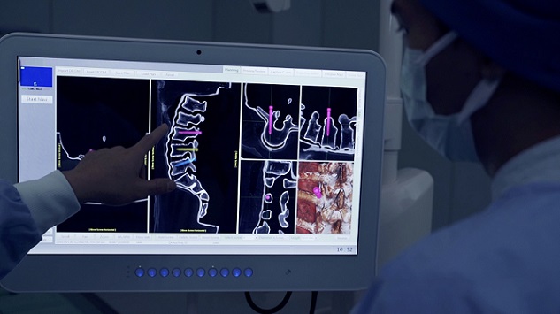 Captiva Spine announces an exclusive strategic partnership with REMEX ...