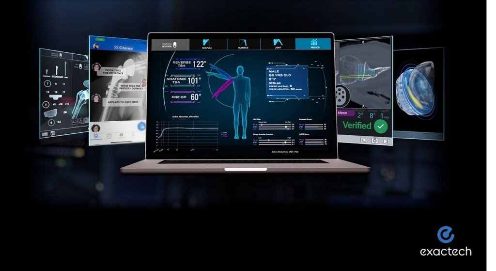 US Patent Issued for Exactech’s Predict+™, First Machine Learning-Based ...