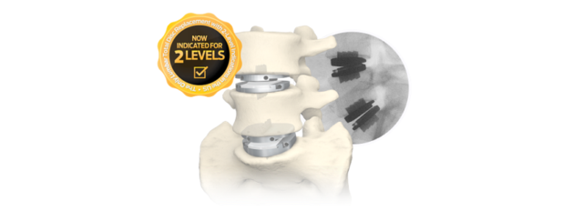New CPT Code Now Effective for Second Level of Lumbar Total Disc ...