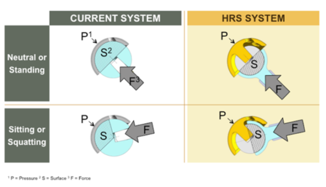 Total Hip Arthroplasty — New Advance Changes the Game – Ortho Spine News