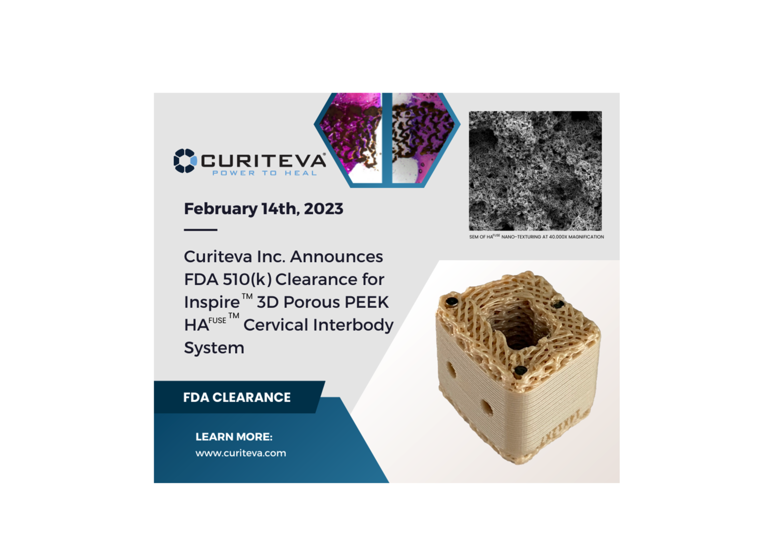 Kolosis BIO and MTF Biologics Extend Exclusive Agreement – Ortho Spine News