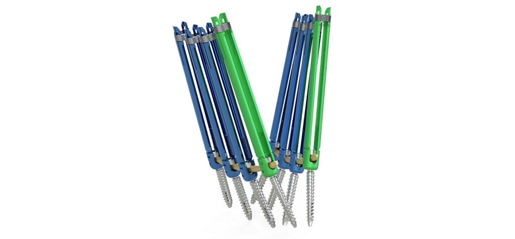 ulrich medical USA® Announces First Percutaneous Spine Case for ...