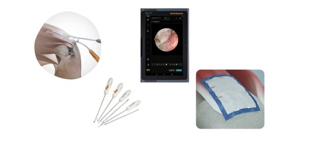 Smith+Nephew Sports Medicine advances procedural innovation by ...
