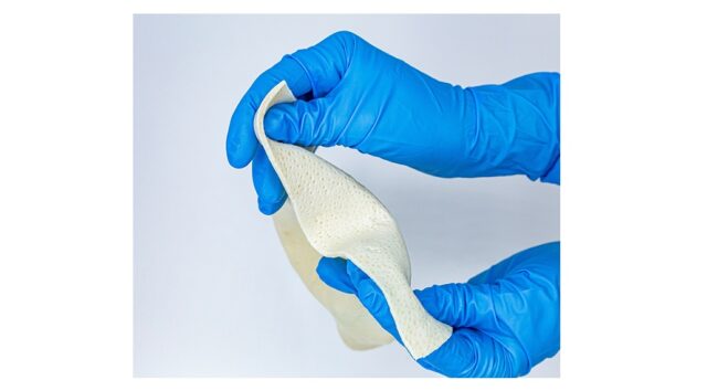 AlloSource Launches AlloMend Duo Acellular Dermal Matrix, A Natural ...