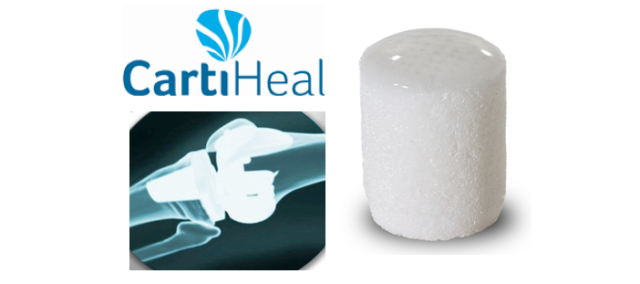CartiHeal Announces First Commercial Implantation of Agili-C™ in the US ...