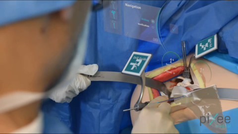 Pixee Medical: Revolutionizing Total Shoulder Arthroplasty with Cutting ...