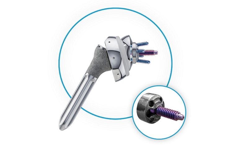 Anika Announces the Full Market Release of the RevoMotion™ Reverse ...