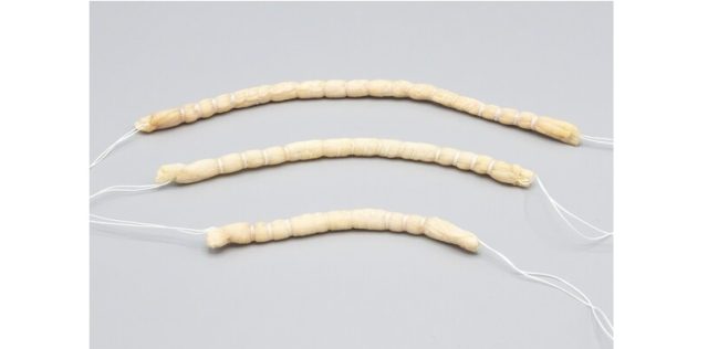 AlloSource Announces First Implant of AceConnex™ Pre-Sutured Fascia ...