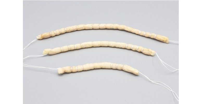 AlloSource Announces First Implant of AceConnex™ Pre-Sutured Fascia ...