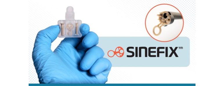 Inovedis Announces First Patients Treated with the SINEFIX™ Rotator ...