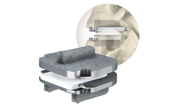 Centinel Spine® Extends Leadership in Total Disc Replacement through ...