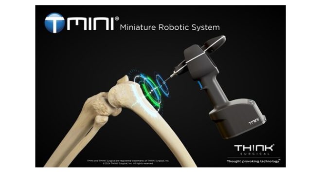 THINK Surgical Announces Its TMINI Miniature Robotic System Procedure ...