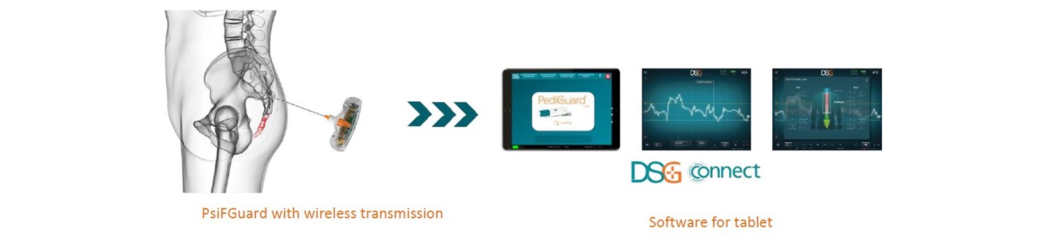 SpineGuard Announces the Commercial Launch of its “PsiFGuard” New Smart ...