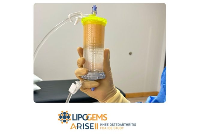 RSIP Vision Announces Breakthrough AI technology for 3D Reconstruction ...