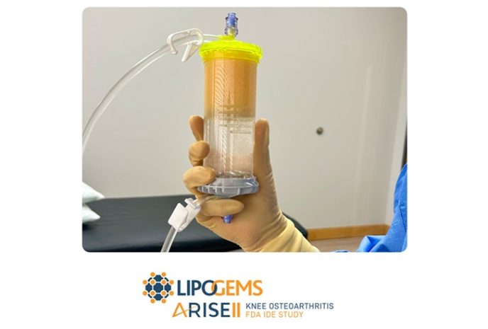 RSIP Vision Announces Breakthrough AI technology for 3D Reconstruction ...