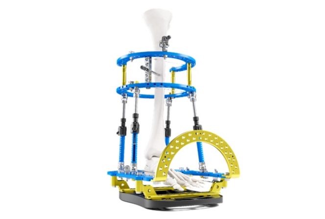 First Knee Replacement Surgery Successfully Completed Using Augmented ...