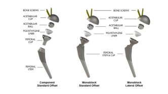 Orthoscan Unveils VERSA: A New Era in Mini C-Arm Imaging – Ortho Spine News