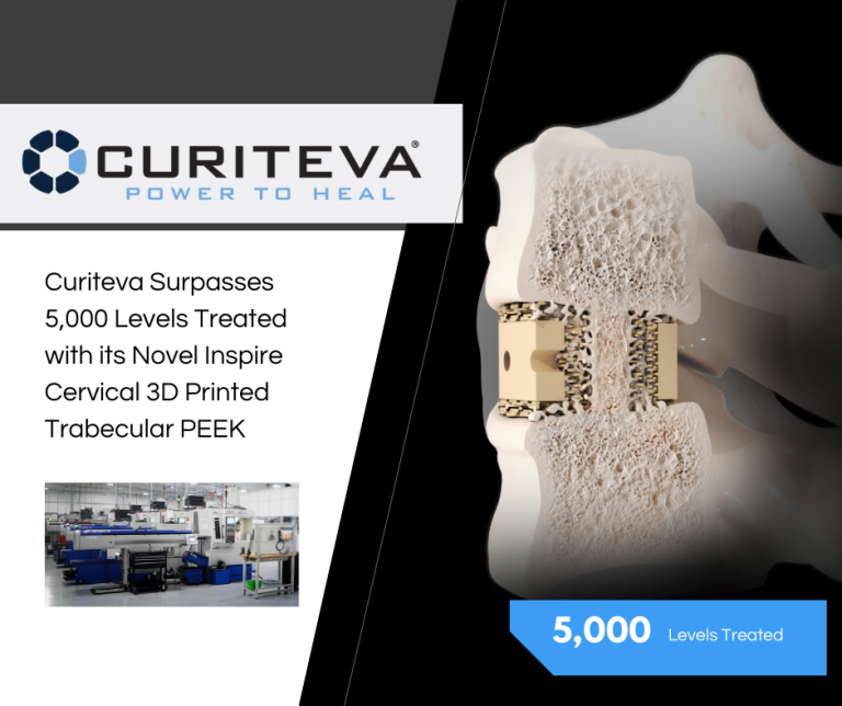 Curiteva Surpasses 5,000 Levels Treated with its Novel Inspire Cervical ...