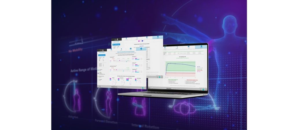Exactech Unveils Next Generation of Predict+®, the First Machine ...