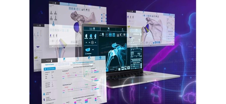 Exactech Launches Next-Generation Shoulder Planning App with Advanced ...