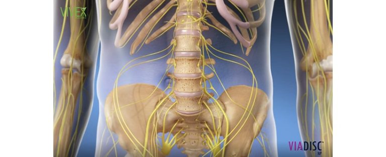 Vivex Biologics, Inc. Completes Subject Enrollment for its ASCEND Trial ...