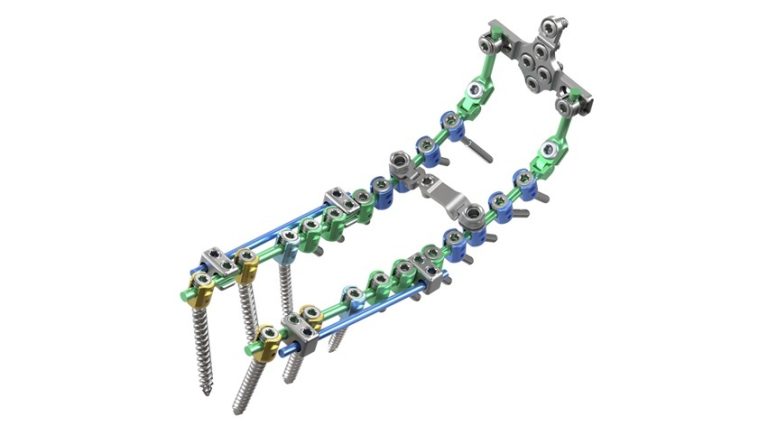 ulrich medical USA® Announces Full Market Launch of Cortium® Universal ...