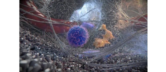 Carlsmed’s aprevo® Personalized Interbody Implants Receive CMS New ...