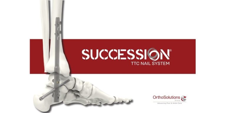 OrthoSolutions® Announces FDA 510(k) Clearance for SUCCESSION® TTC Nail ...