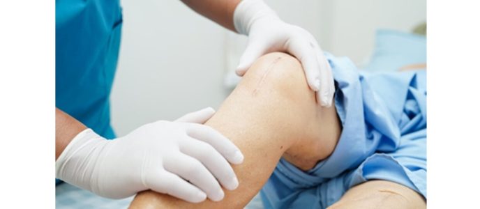 OrthoSolutions® Announces FDA 510(k) Clearance for SUCCESSION® TTC Nail ...