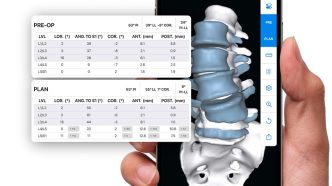 Centinel Spine® Receives MDR Certification for prodisc® C Vivo and ...