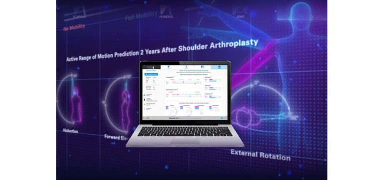Exactech Unveils First Large-Scale CT Radiomic Analysis of Shoulder ...
