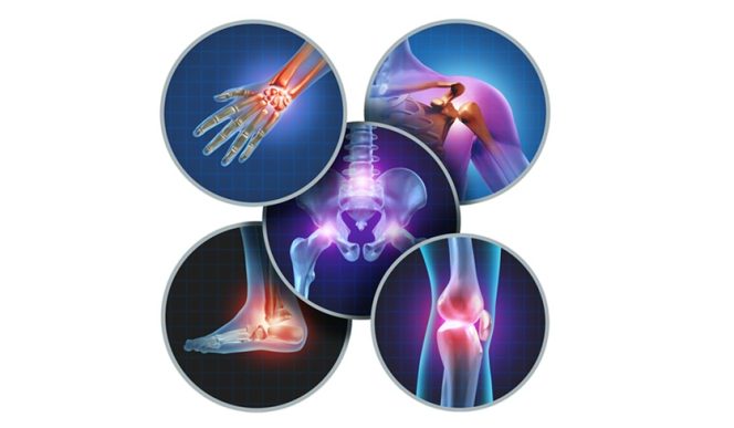 Paragon 28® launches first-of-its-kind in soft tissue fixation for the ...