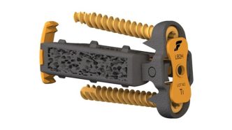 CurvaFix Secures FDA Clearance to Advance Pelvic Fracture Treatment ...