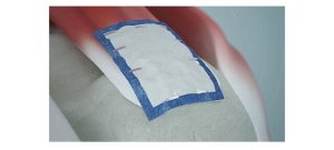 Smith+Nephew unveils major clinical evidence and patient access updates ...