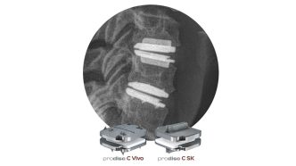 Smith+Nephew announces new category I CPT® code for its CARTIHEAL ...