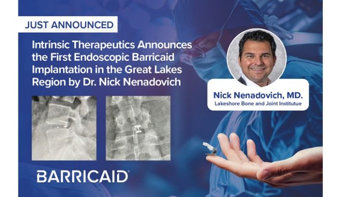 Intrinsic Therapeutics Announces the First Endoscopic Barricaid ...