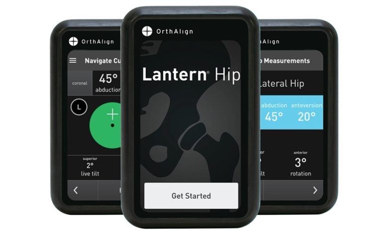 OrthAlign Expands Lantern® Hip Platform to Support Posterior-Based ...