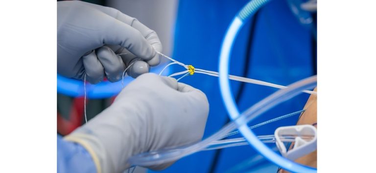 Arthrex Releases TightRope® SB All-Suture Implant for ACL Fixation ...